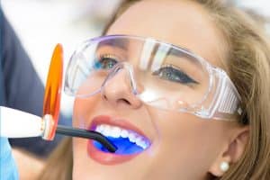 How Long Can a Root Canal Last Without a Crown?