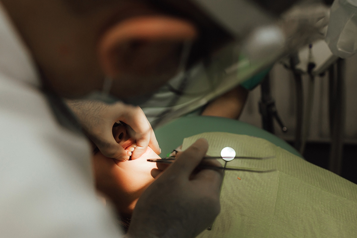 What Is an Apicoectomy? Procedure, Benefits, and When It's Needed ...